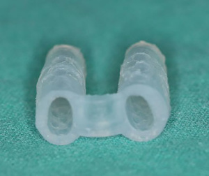 A new cleft palate device is created in Thailand - DeRouen Center